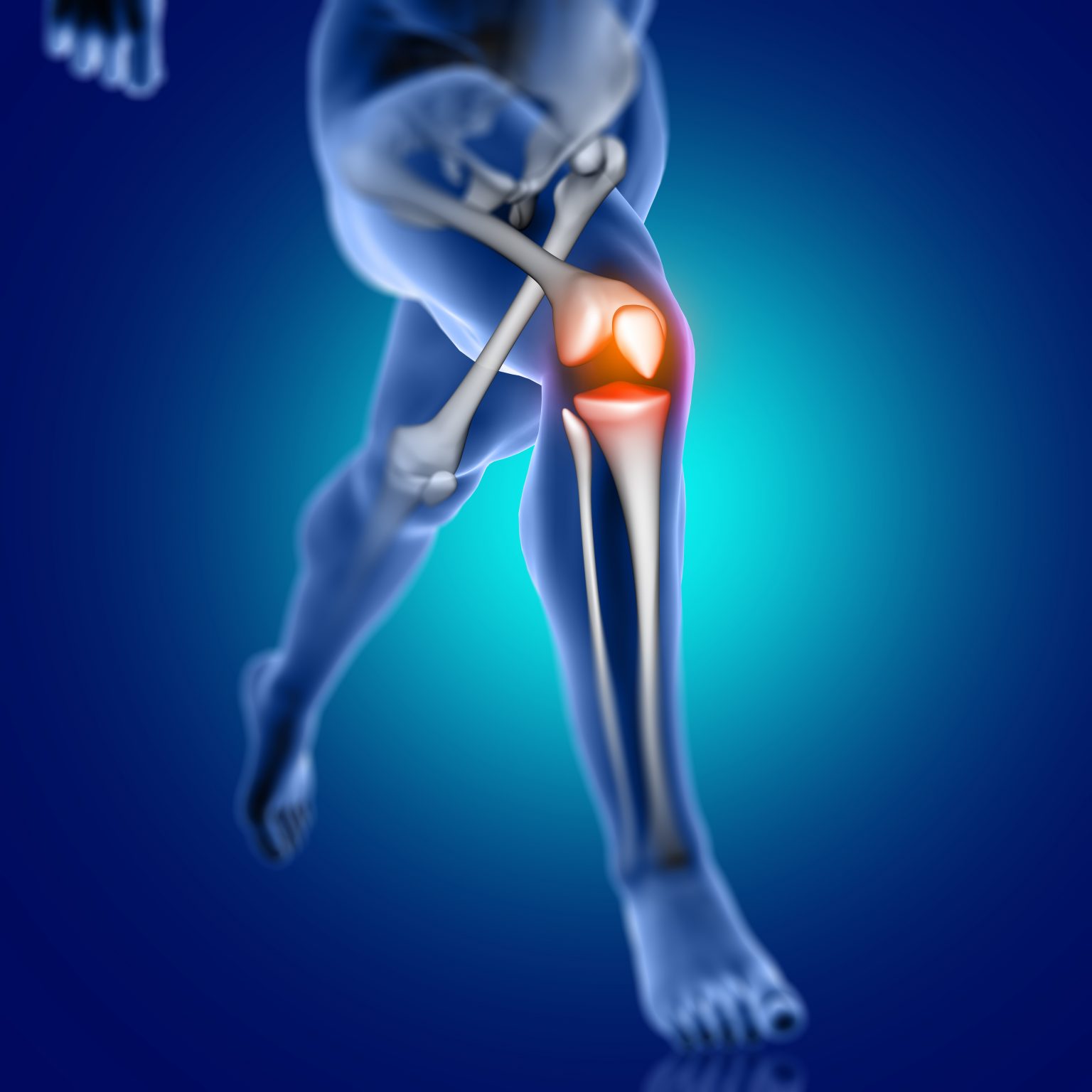 What are the benefits of knee replacement surgery?